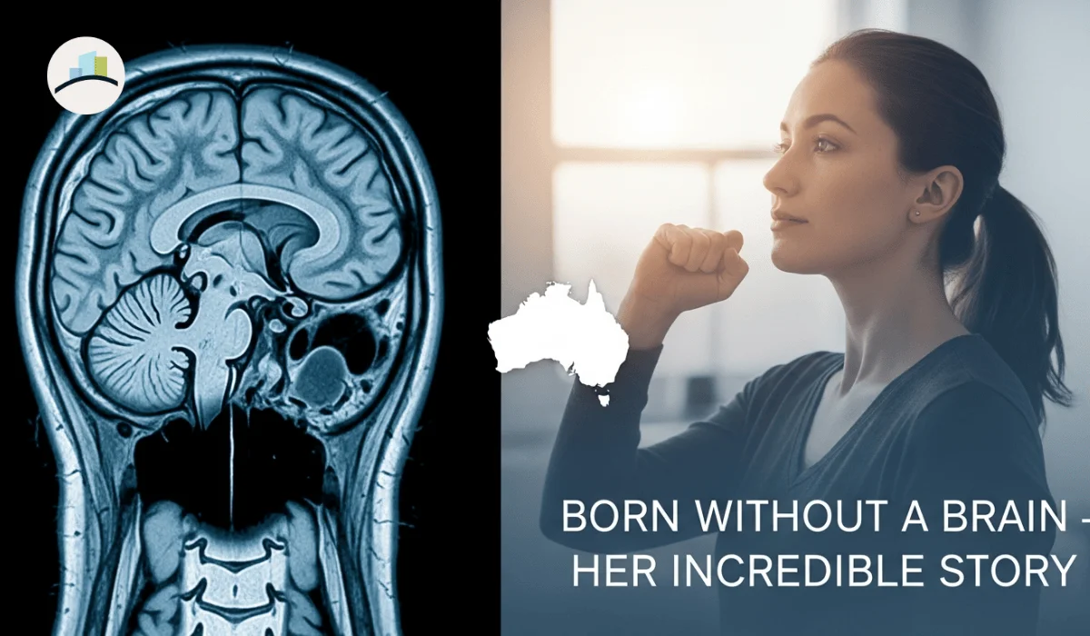 Woman Born Without a Brain Region – The Astonishing True Story ...