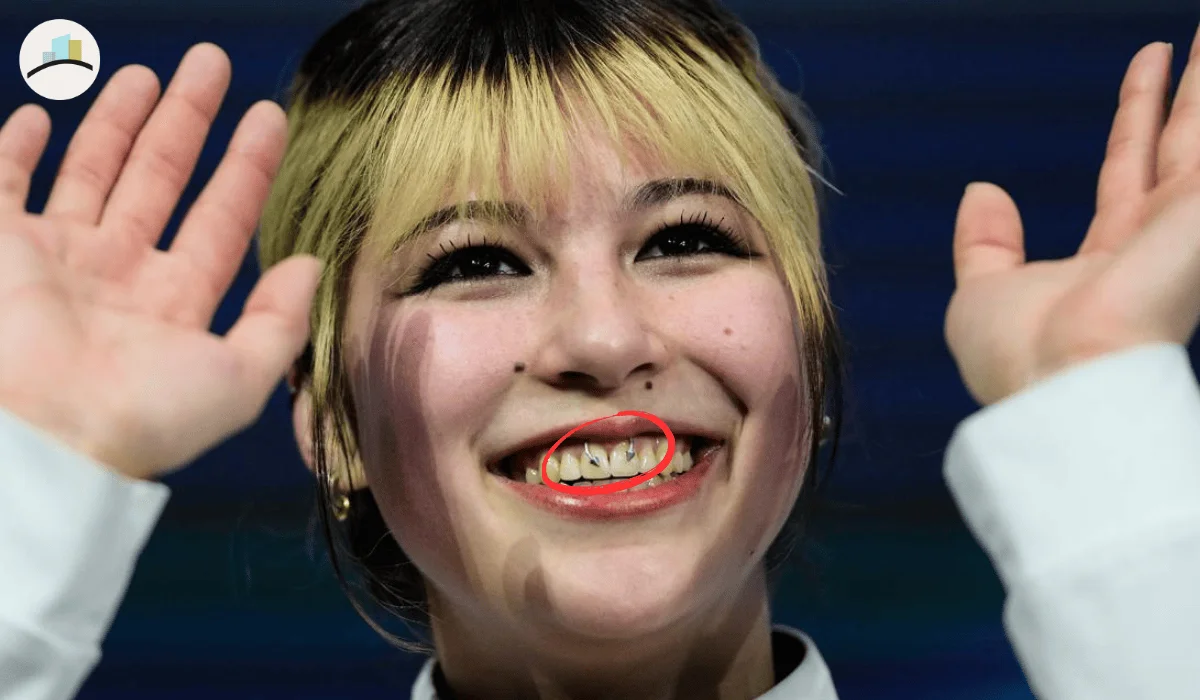Alysa Liu Front Teeth Piercing: The Truth Behind Her Smiley Piercing ...